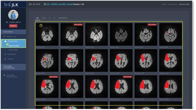 [디지털대전환]①AI 만난 의료·경찰서…"골든타임 잡는다" - 파이낸셜뉴스