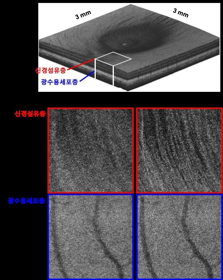 KAIST, 2.3초 내 세포 수준 고해상도 망막 이미징 첫 구현 - 파이낸셜뉴스