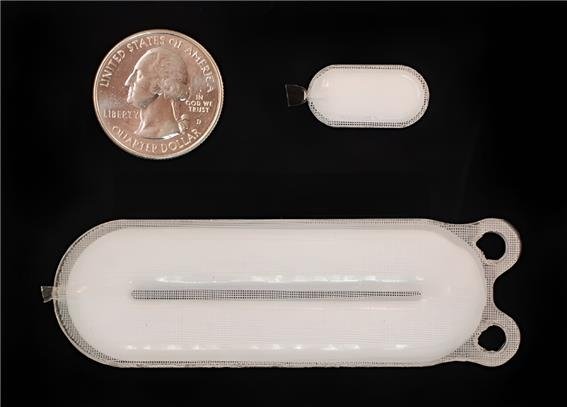 "1형 당뇨병 베타세포 임플란트 치료법 효과 있다" - 파이낸셜뉴스